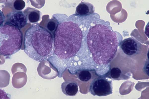 » Nucleated Red Blood Cells (NRBC)